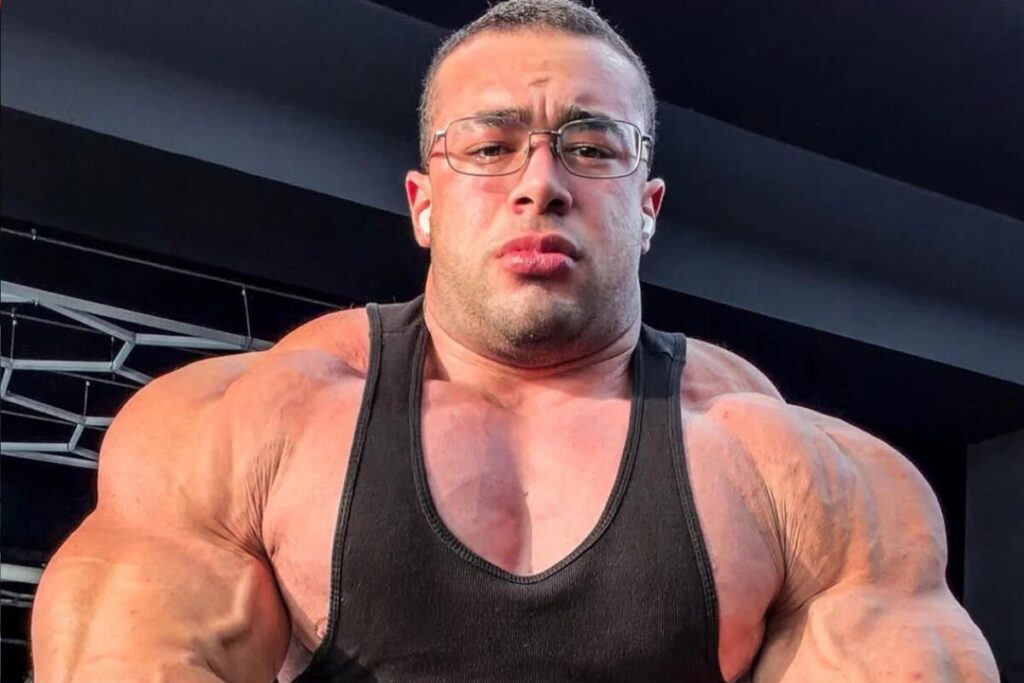 22-year-old bodybuilder struggles to breathe due to steroid side effects