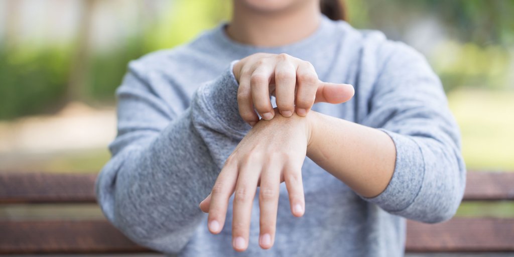 Fortes chaleurs : ce type d’eczéma méconnu est amplifié par la canicule ...