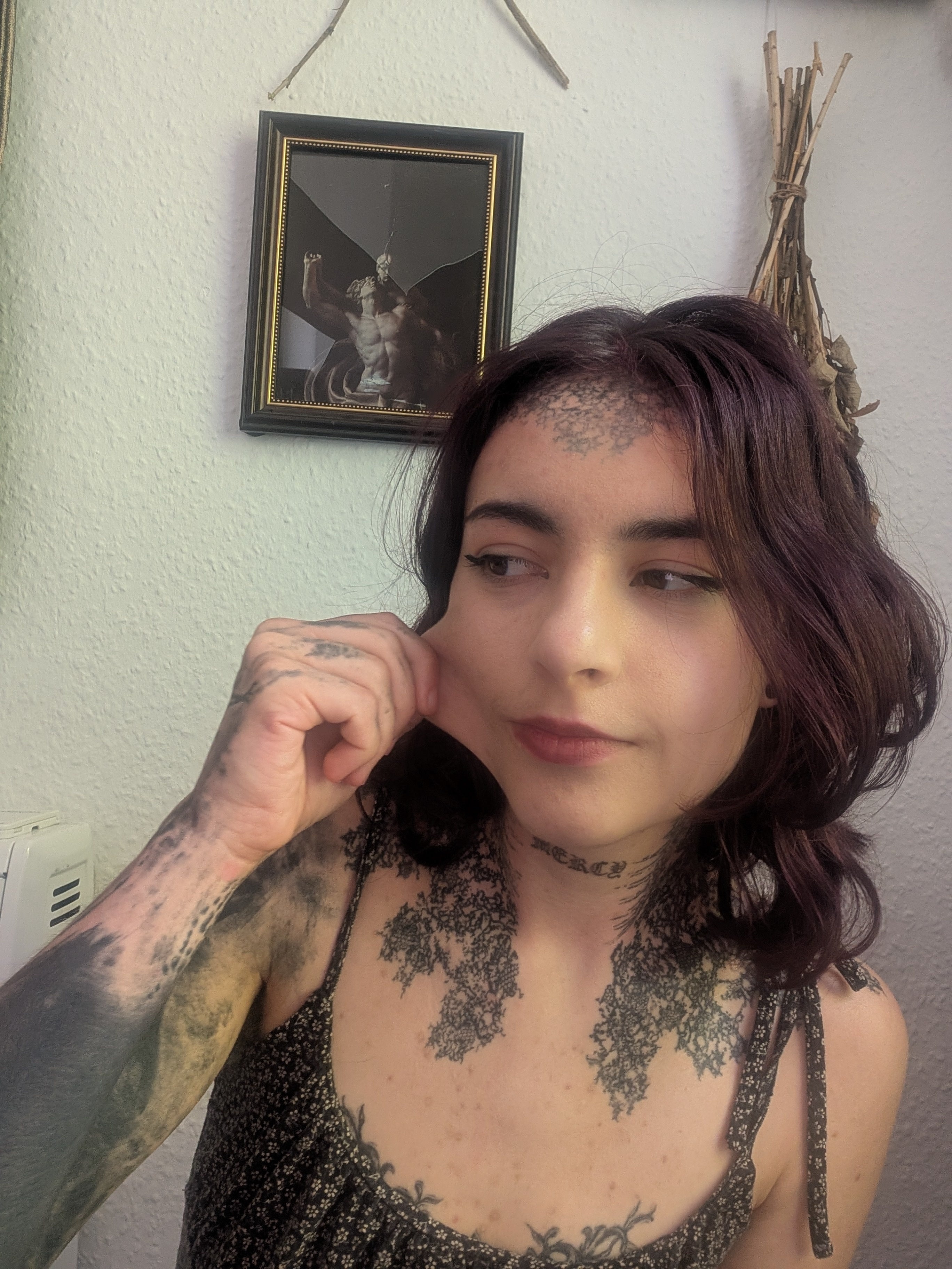 Student’s 'trick' of stretching skin turns out to be rare condition