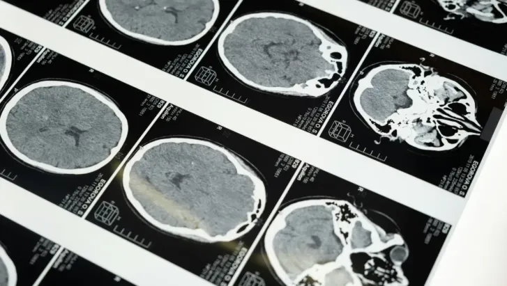 Chronic diseases to drive MRI systems market 2031 expansion to $9.68b