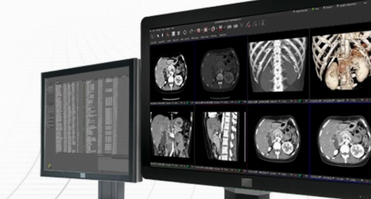 Pro Medicus signs $44M in health contracts