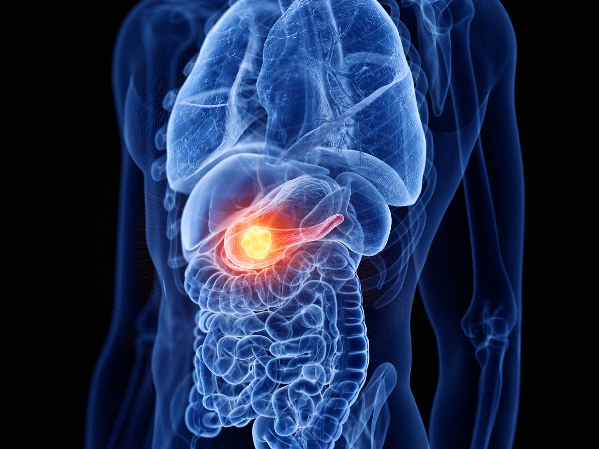 New daily pill can double survival time for world's deadliest cancer ...