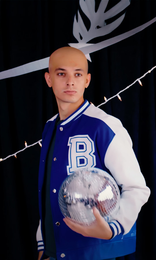 Teased for going bald?