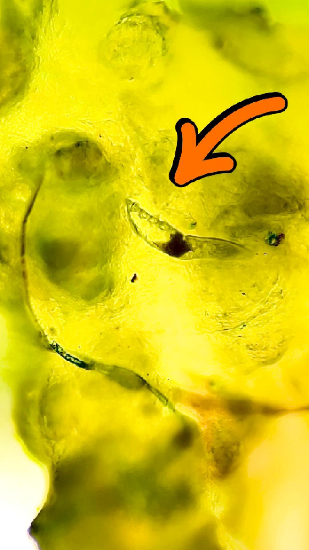 The tiny creatures living on your face right now