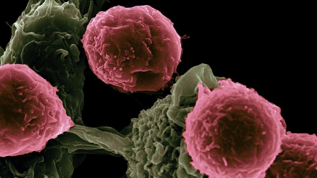 Oncologists give standing ovation for breakthrough pancreatic drug ...