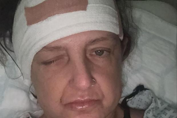 Swindon woman ended up in coma after 111 told her to just take paracetamol