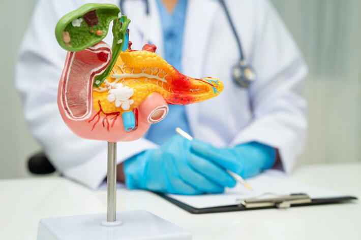 Novo comprimido pode dobrar a sobrevida de pacientes com câncer de ...