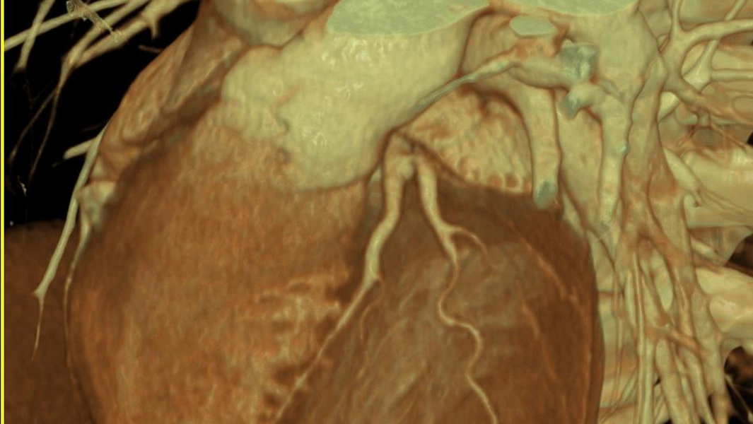 Doctors flag missing cardiac details in Trump health report