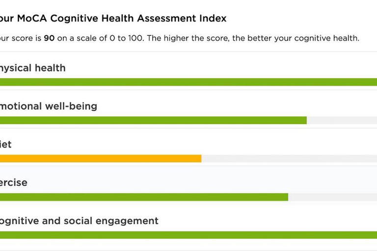 I took the same cognitive test as Donald Trump — the results surprised me