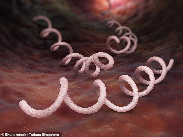 Syphilis cases in women going undiagnosed as symptoms such as hair loss ...
