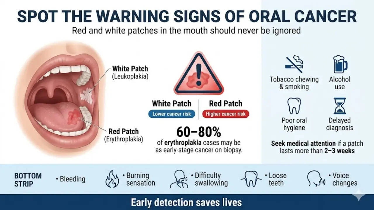 Red vs white patches in the mouth: Which one is a sign of mouth cancer?