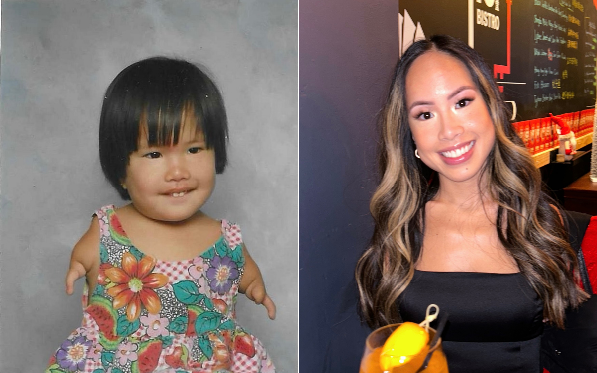 I was born without arms—here’s what I wish I’d told my younger self