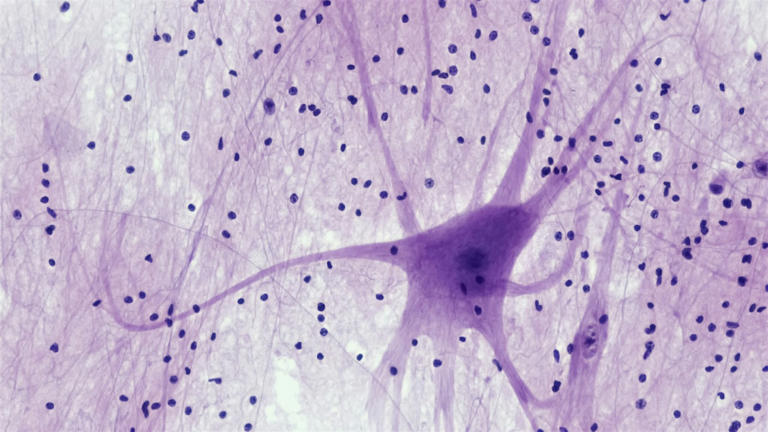 Stanford researchers just found protein traffic jams inside aging ...