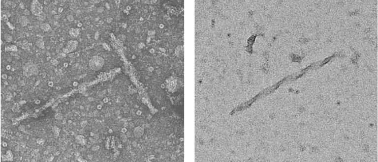 Columbia University researchers discover new clues to Alzheimer’s origins