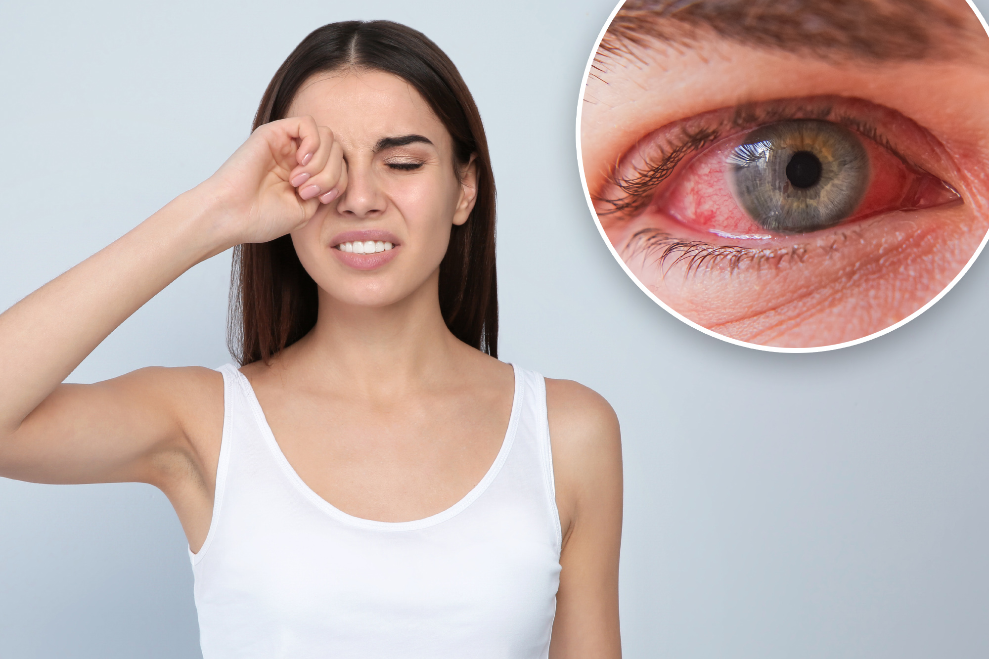 Ophthalmologists reveal surprisingly serious conditions eye rubbing can ...