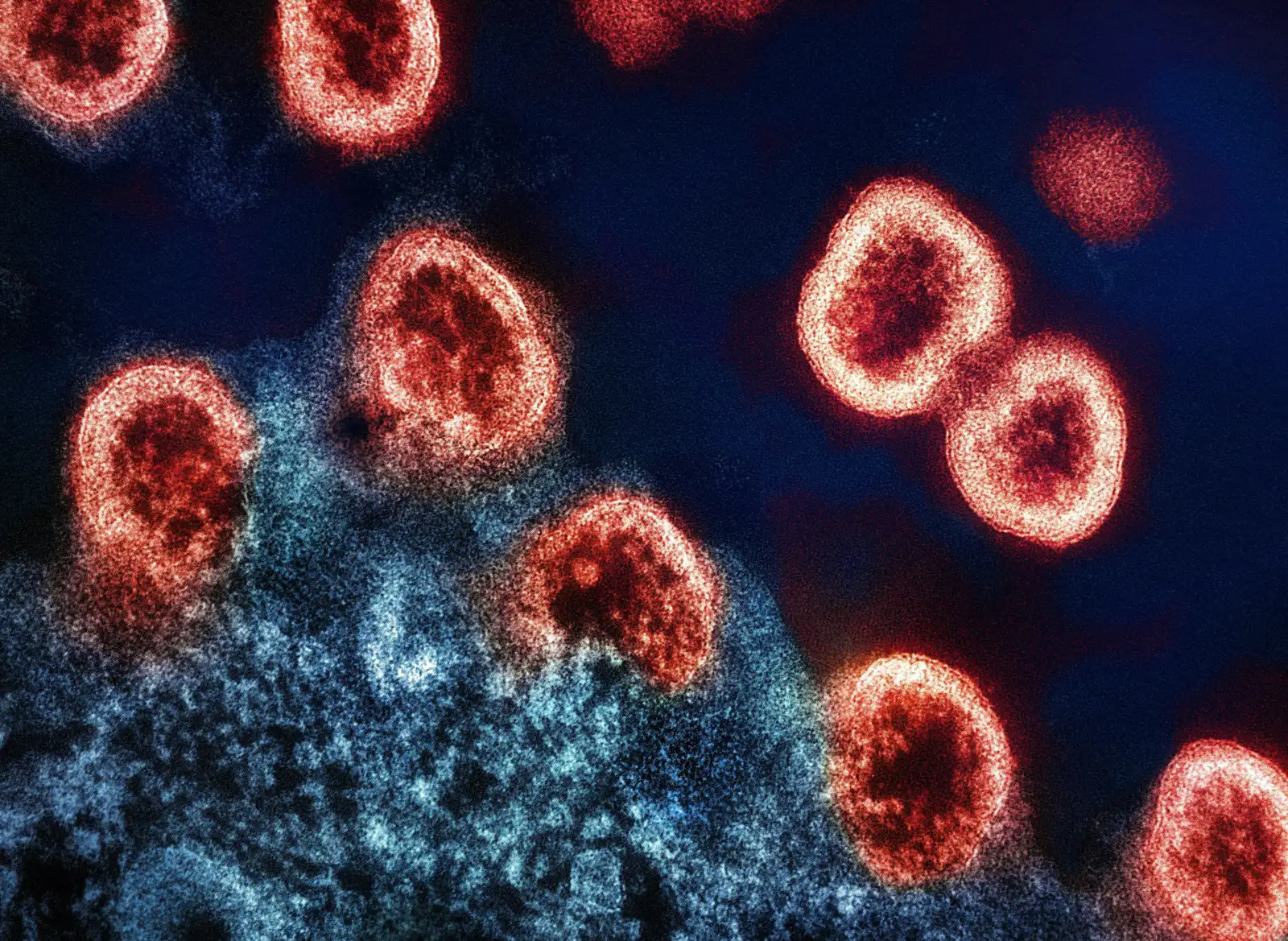 El Niño raises hantavirus risk this summer