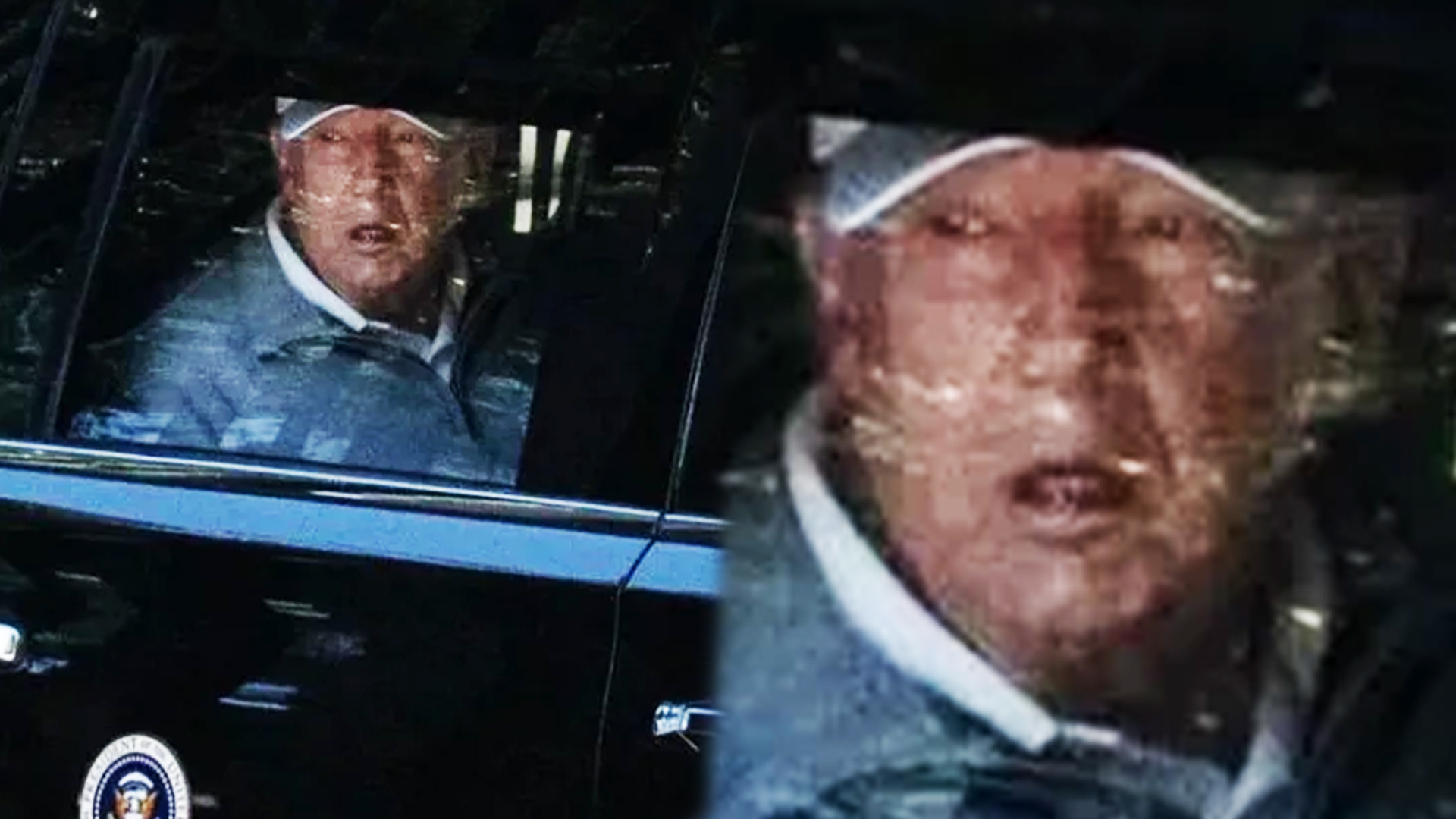 Trump photographed with "dementia face"