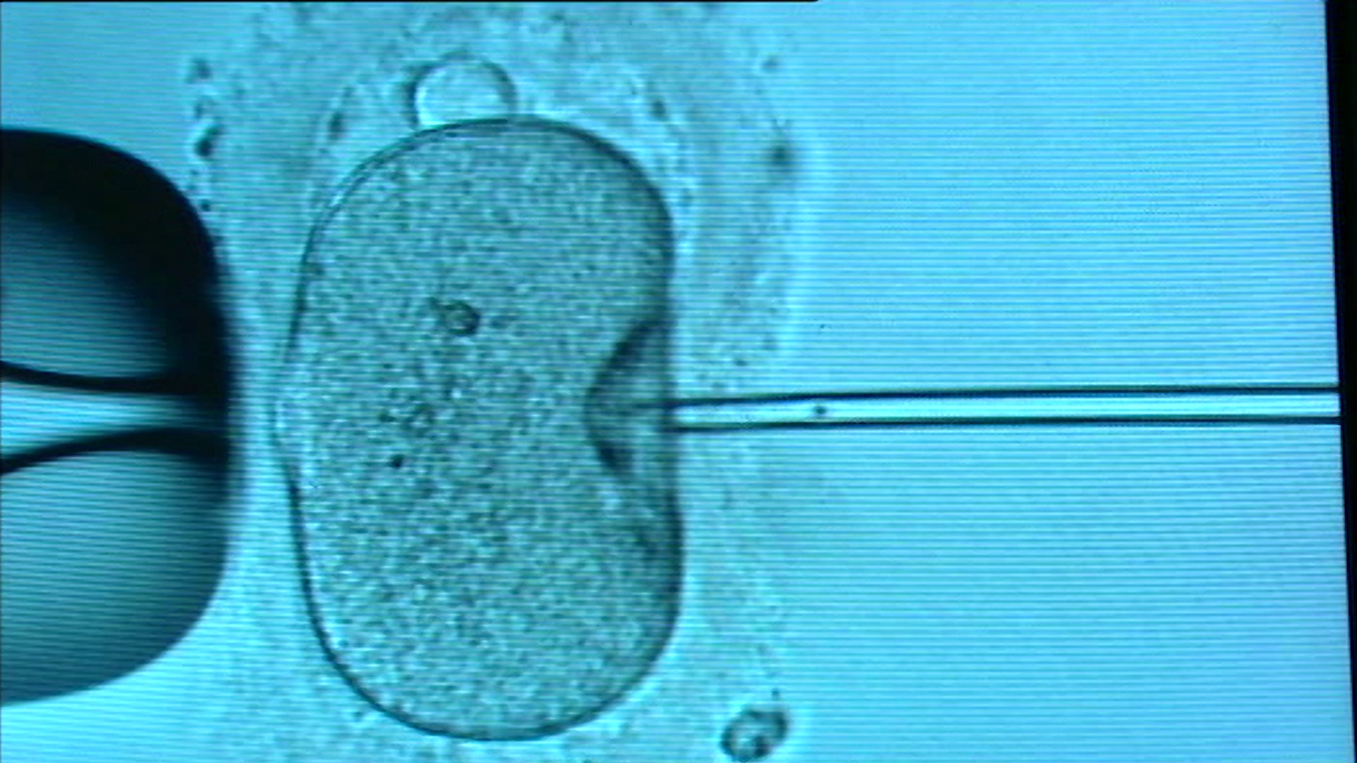 Changes to Victorian law to provide 'tougher scrutiny' after Monash IVF ...