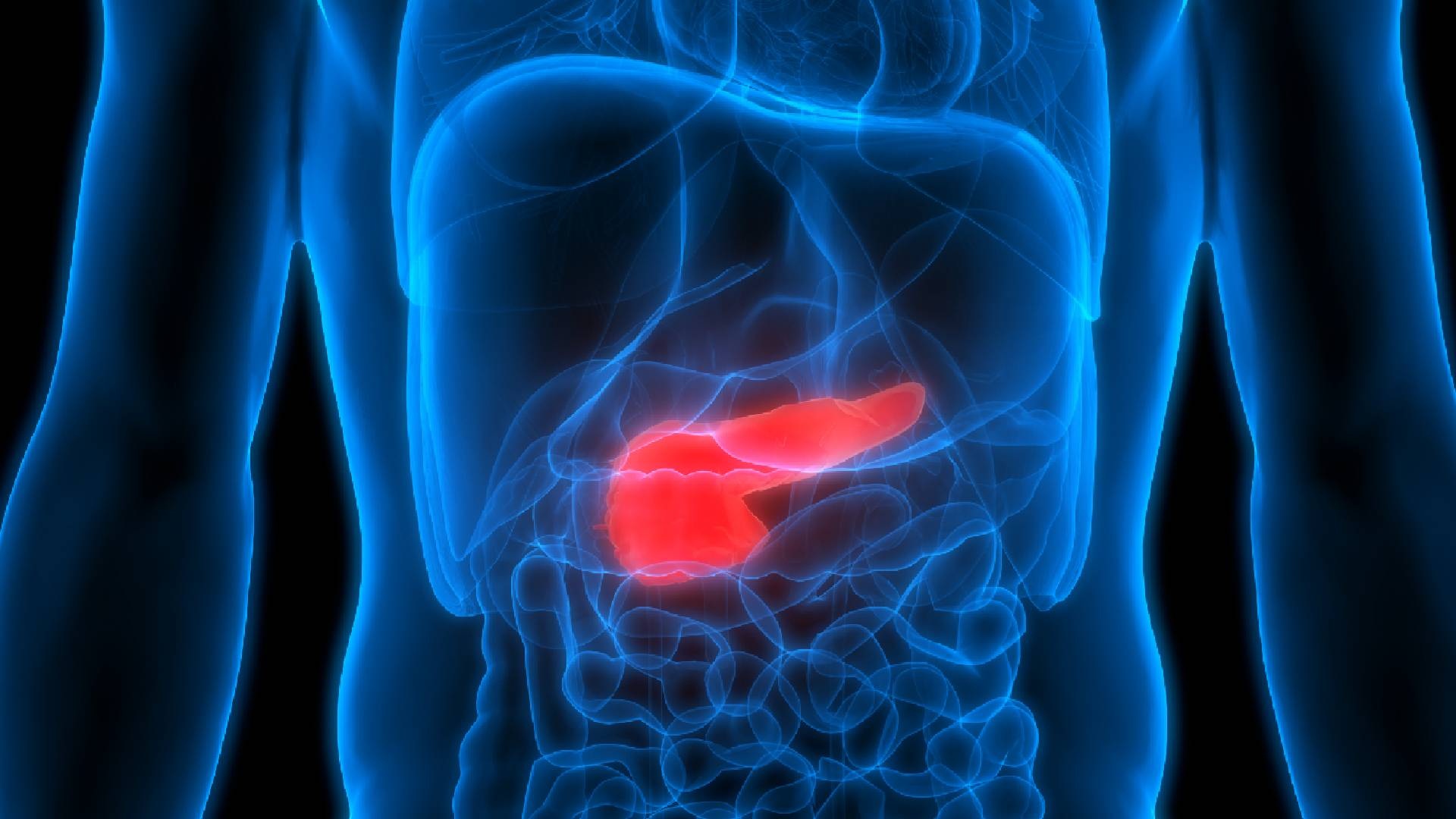 Experimental pancreatic cancer drug nearly doubles survival in Phase 3 ...