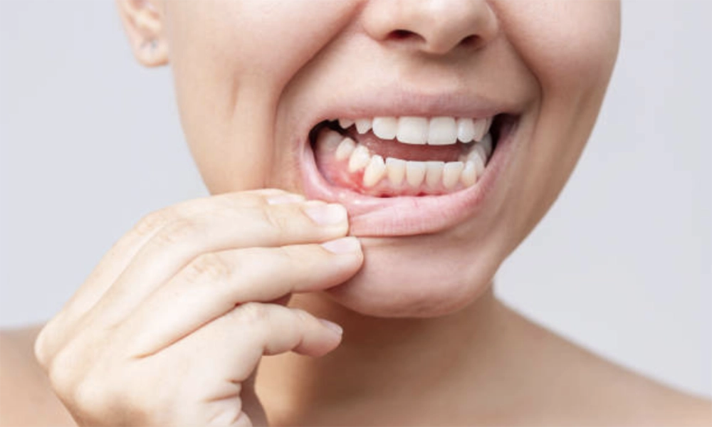 How to reduce the risk of developing gum disease