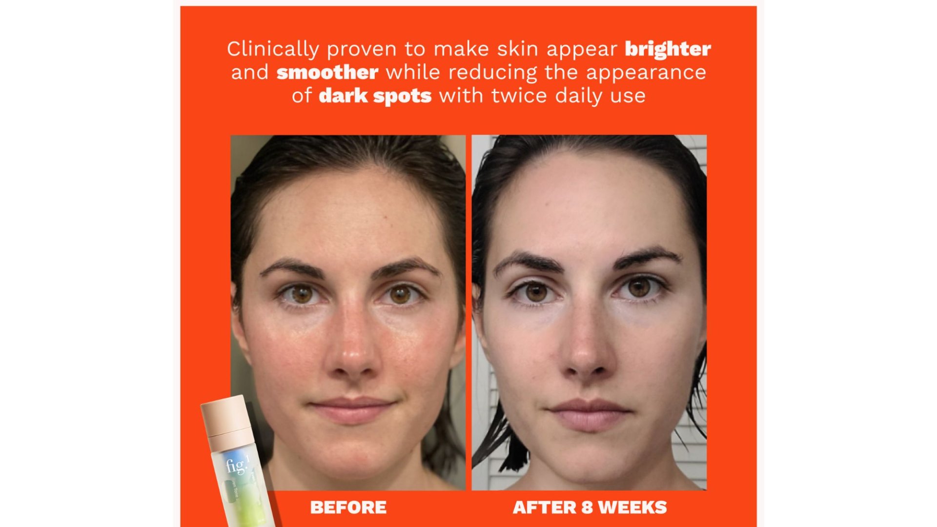 Uneven skin tone? This brightening serum fades dark spots