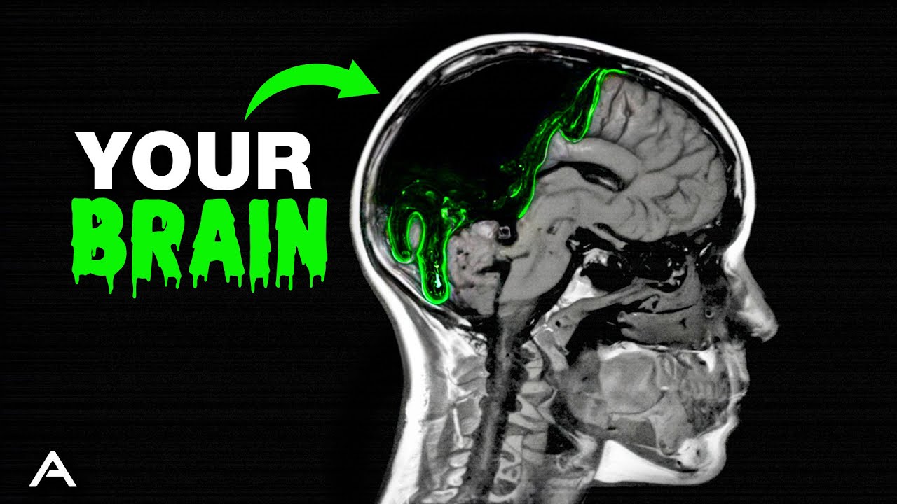 Brain rot is far worse than you think