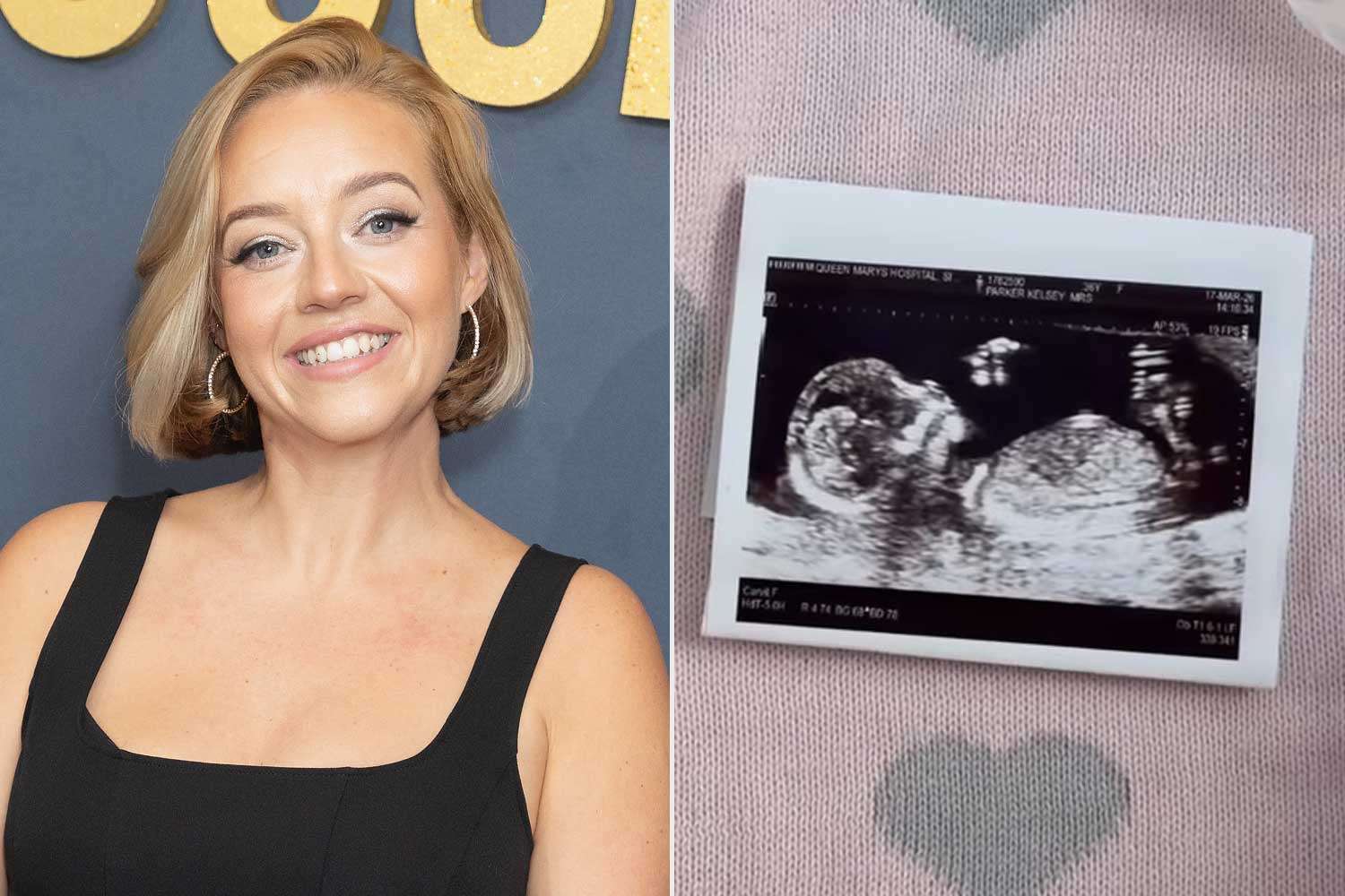 Tom Parker's widow Kelsey is pregnant, expecting 'rainbow baby' 11 ...