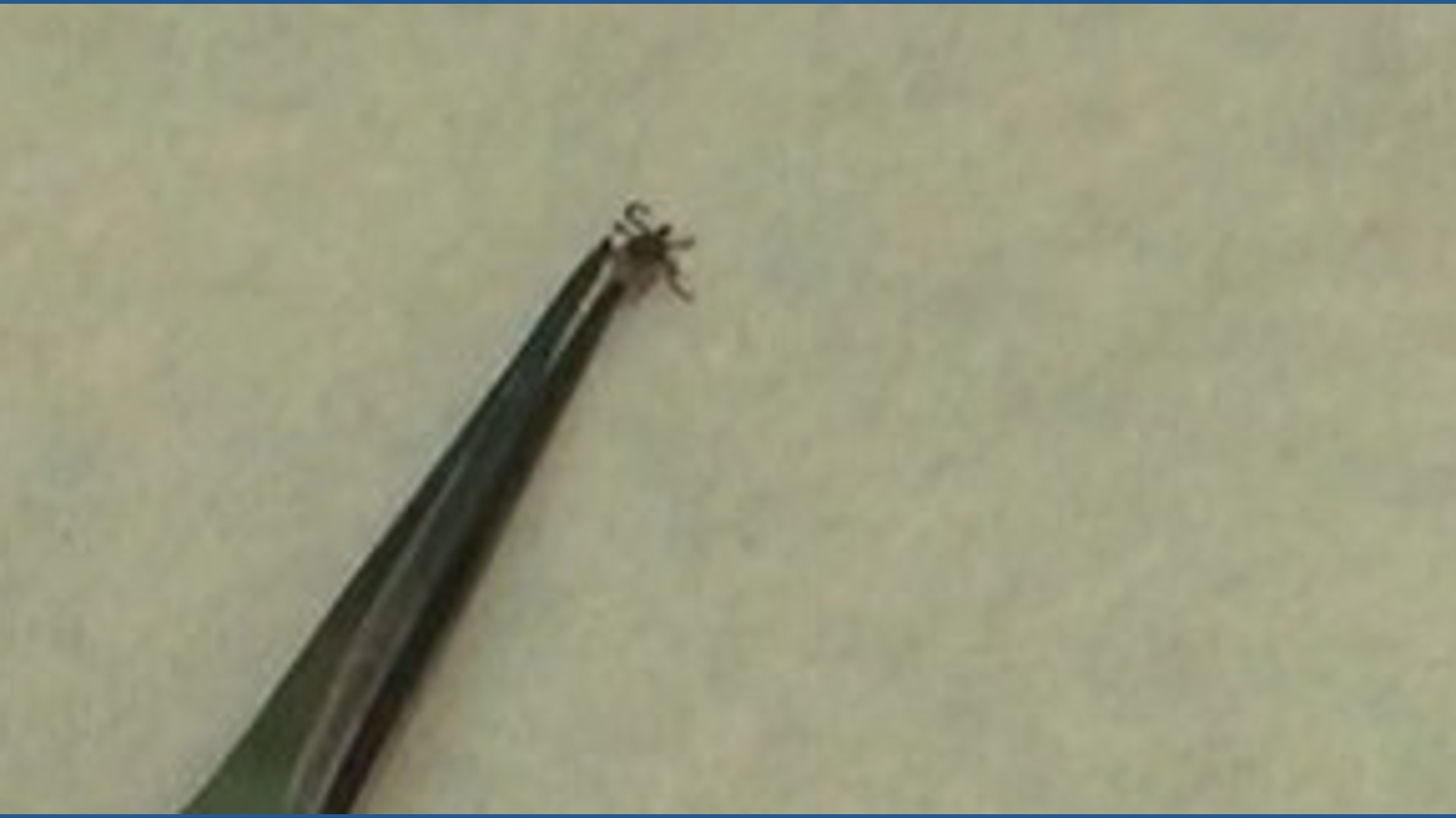 New HHS program hopes to combat Lyme disease cases