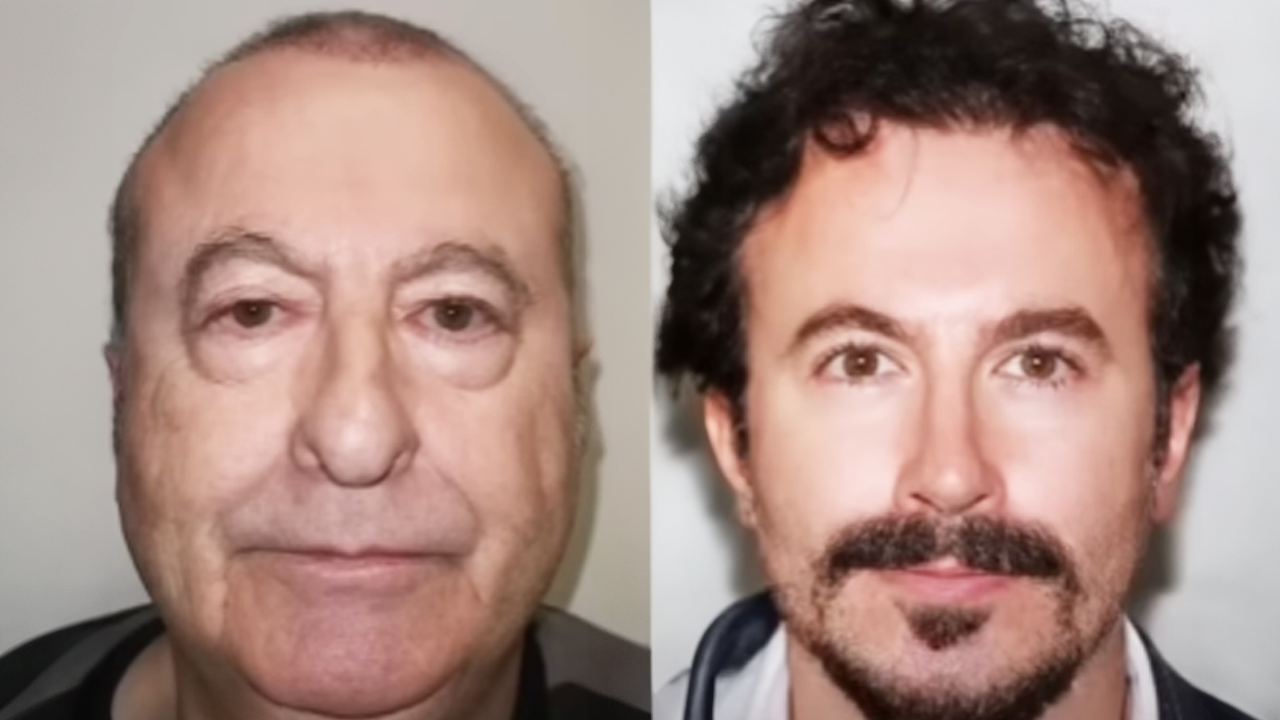 Plastic surgeon analyzes Turkish cosmetic surgery results: real or 'sus'?