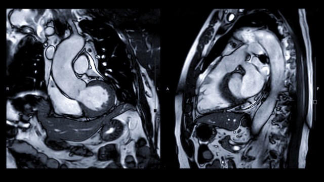 'Human exposure is widespread': Researchers launch $3.3M study into ...