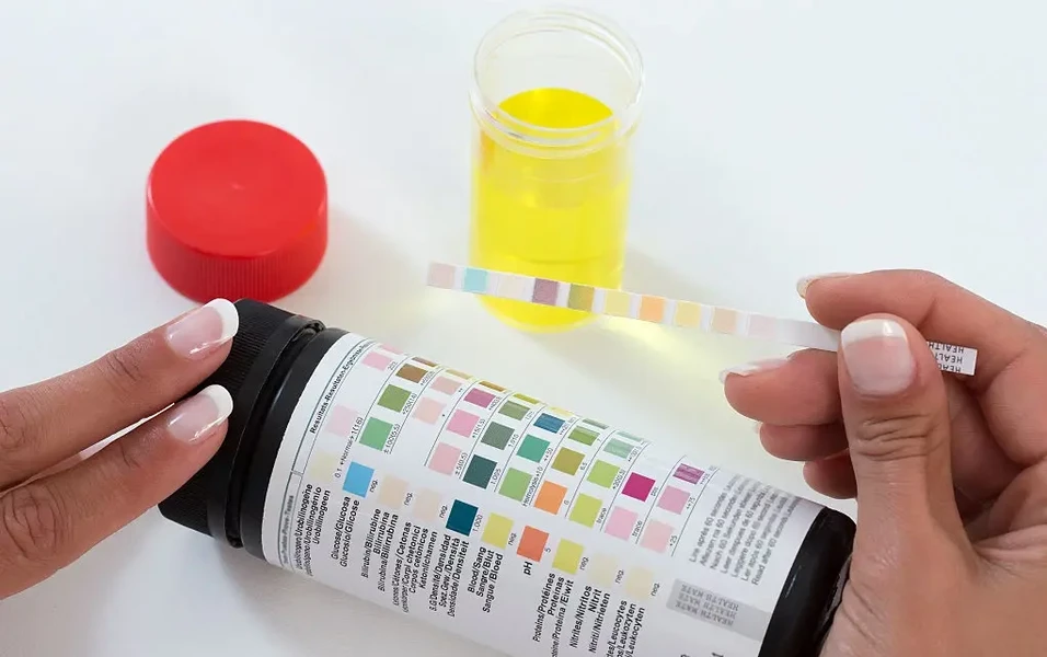 Doctors urge NHS to adopt urine test for early kidney disease detection
