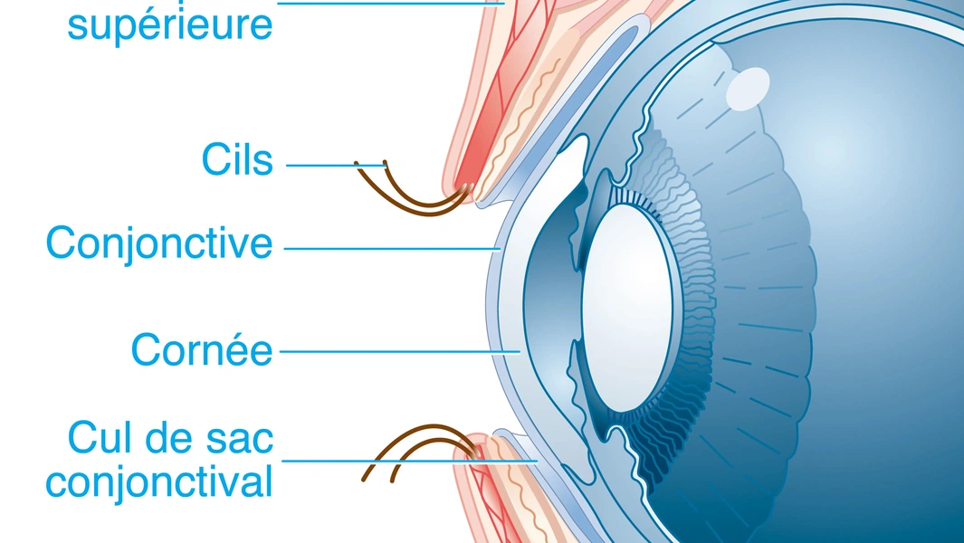 Everyday tips to keep blepharitis under control