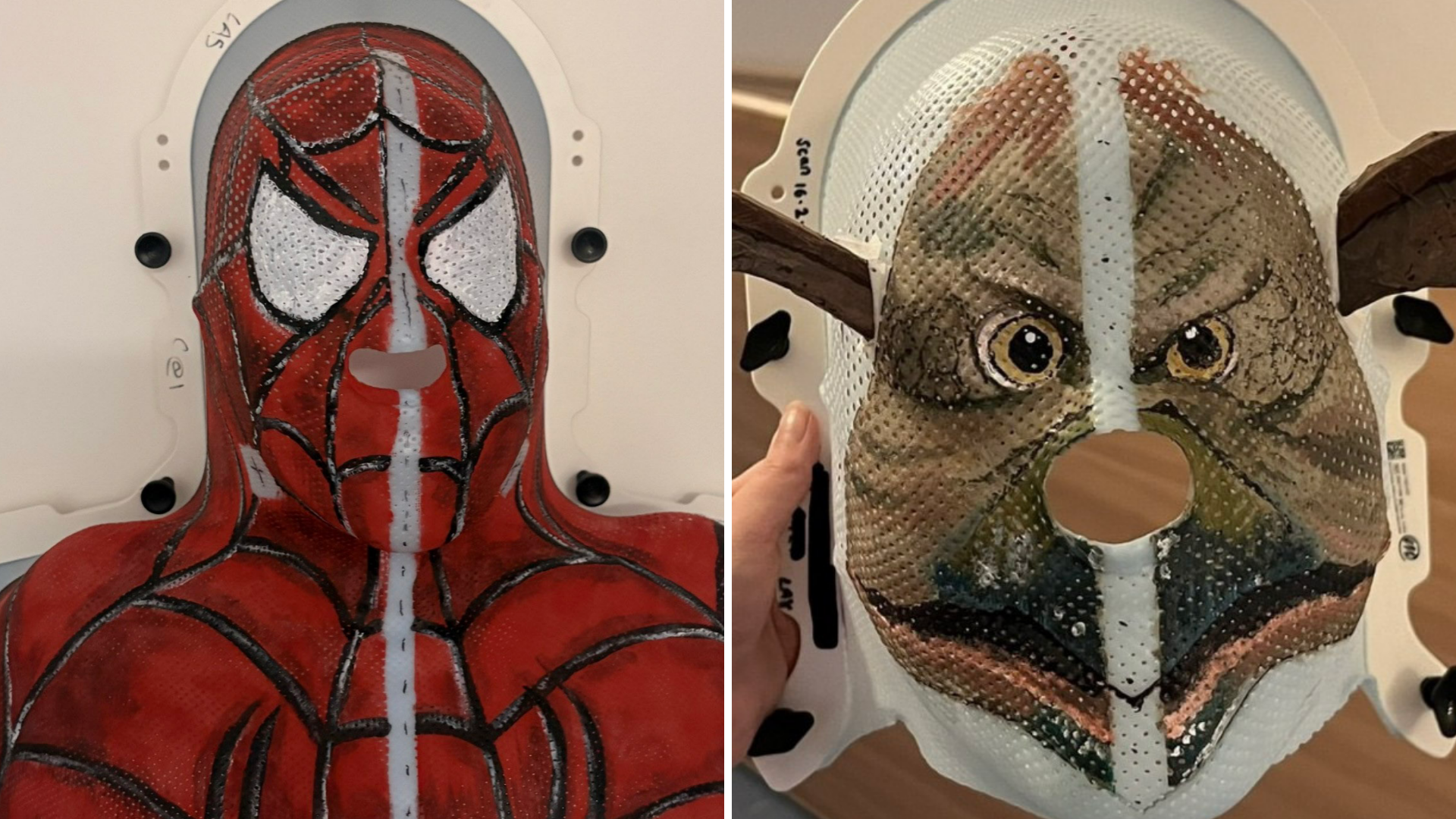Royal audience for radiographers' Spider-Man mask