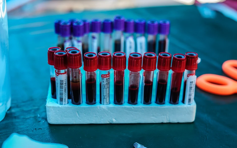 Blood testing decoded for everyday health decisions