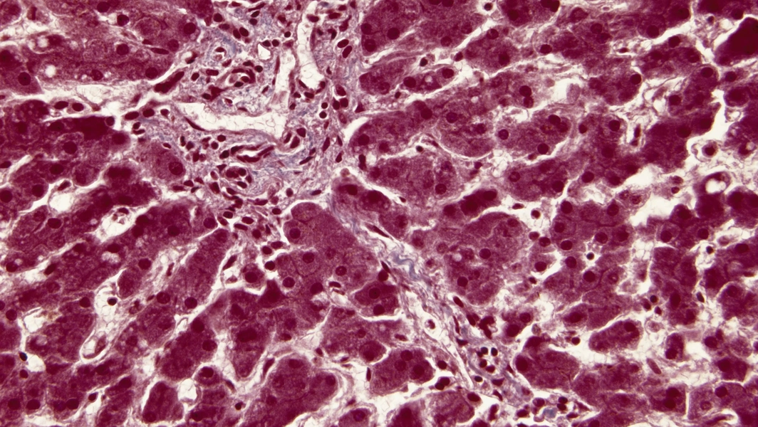 Study links pigeons’ navigation to iron-rich liver cells