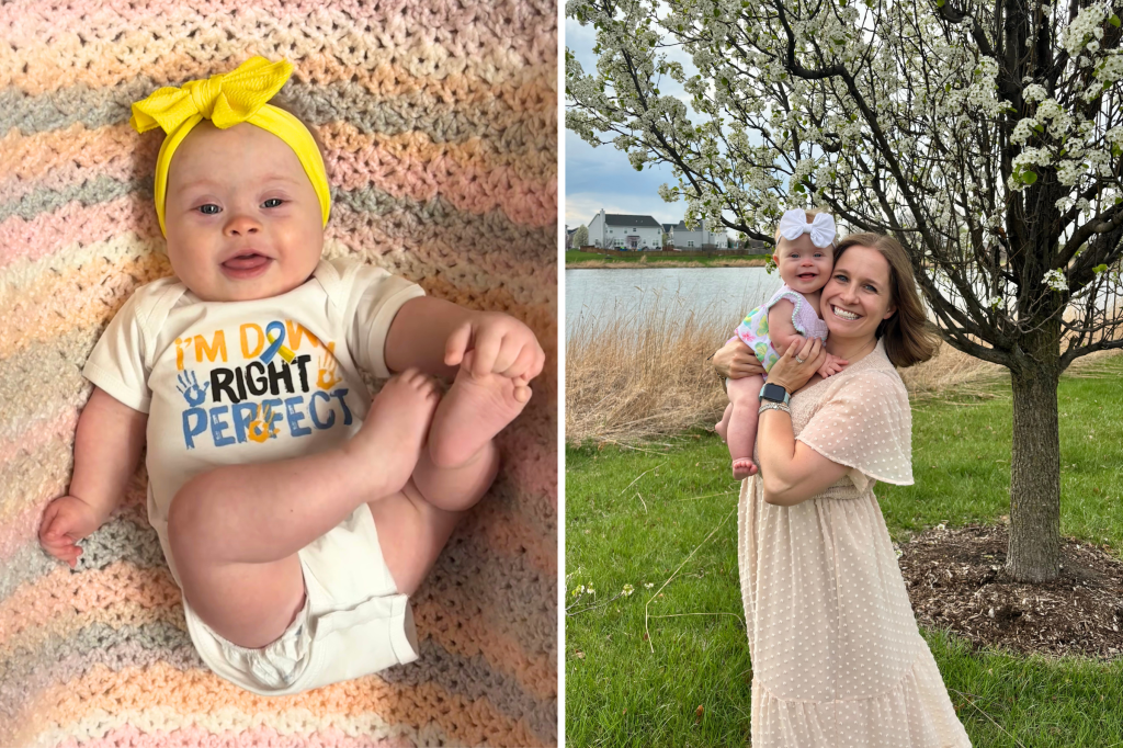 The scan suggested Down syndrome. The doctor’s next words stunned me