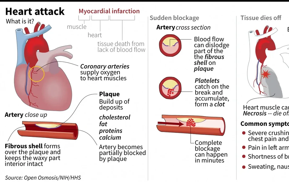 Your heart health game plan for life