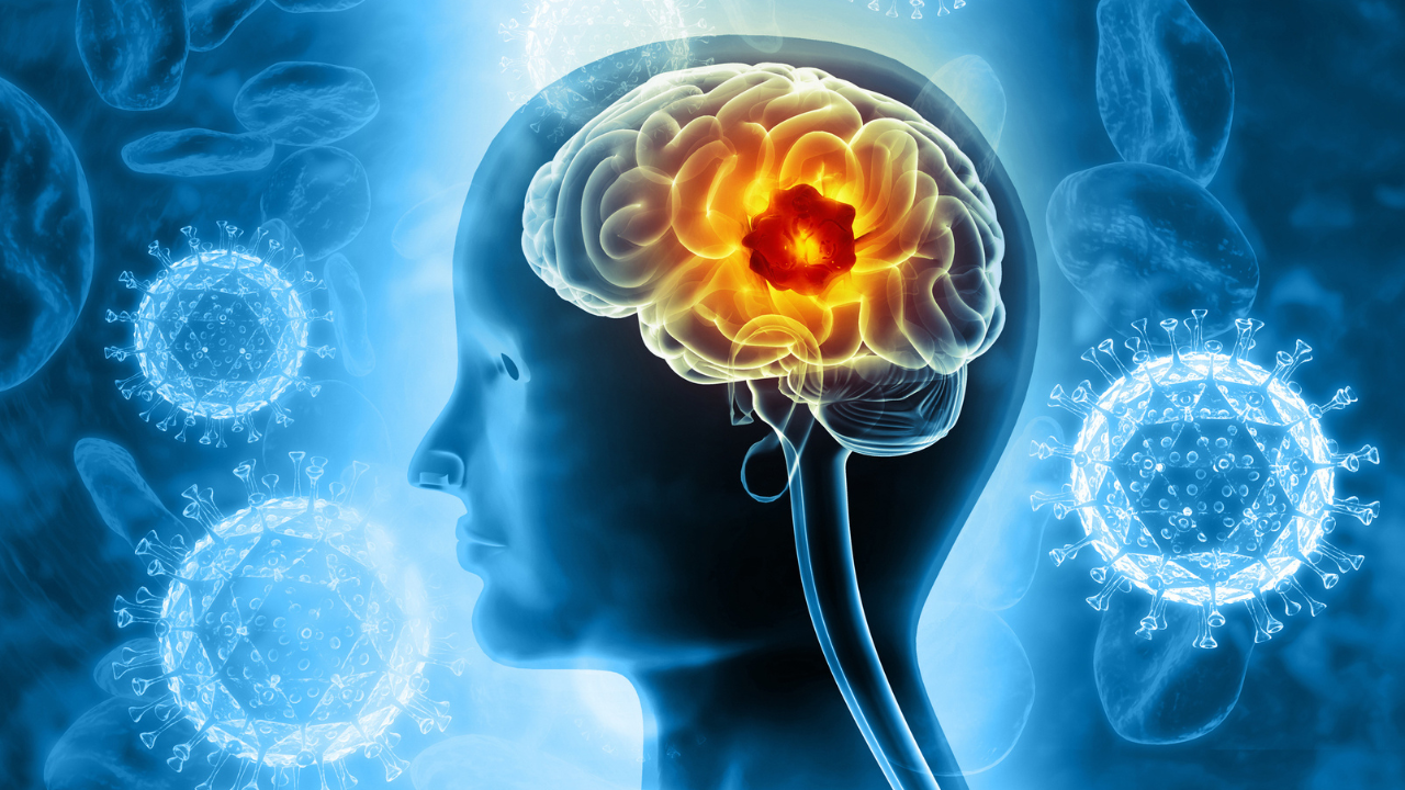 World Brain Tumour Day: Not just tiredness. Warning signs your brain ...