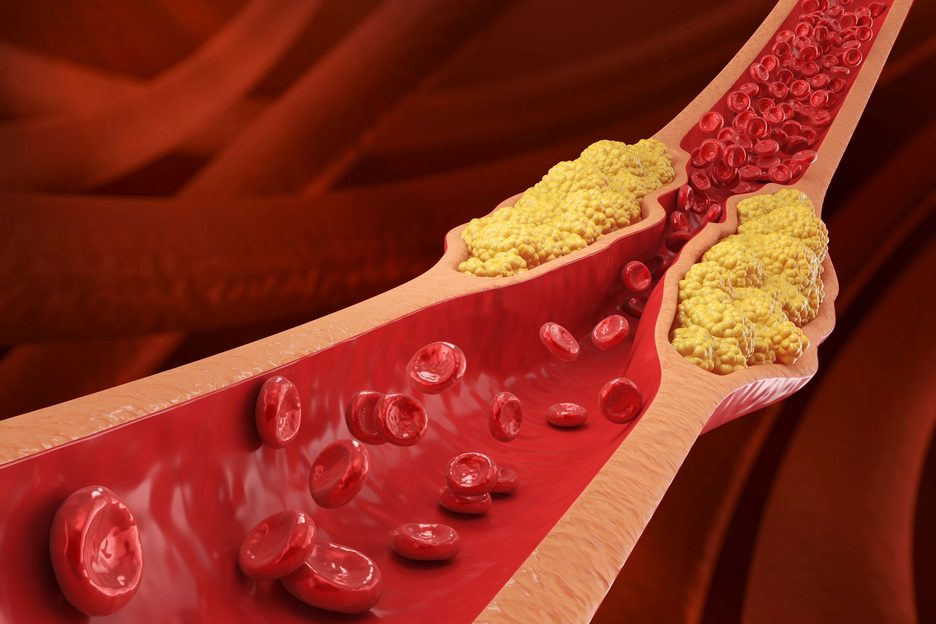 The countries with the lowest (and highest) cholesterol levels in the world