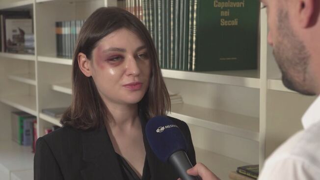 Milano, modella aggredita e picchiata dal "branco" in pieno giorno