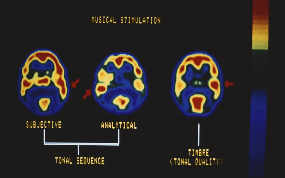 How music rewires your brain and focus