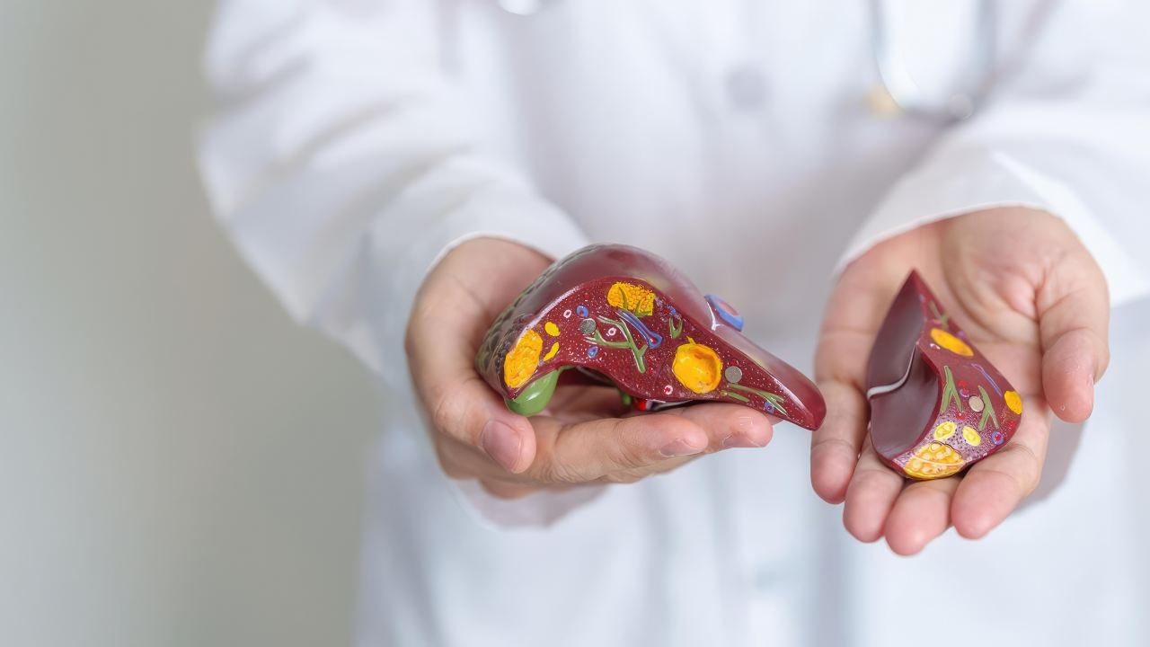 Most people ignore fatty liver until it's too late: Liver transplant ...