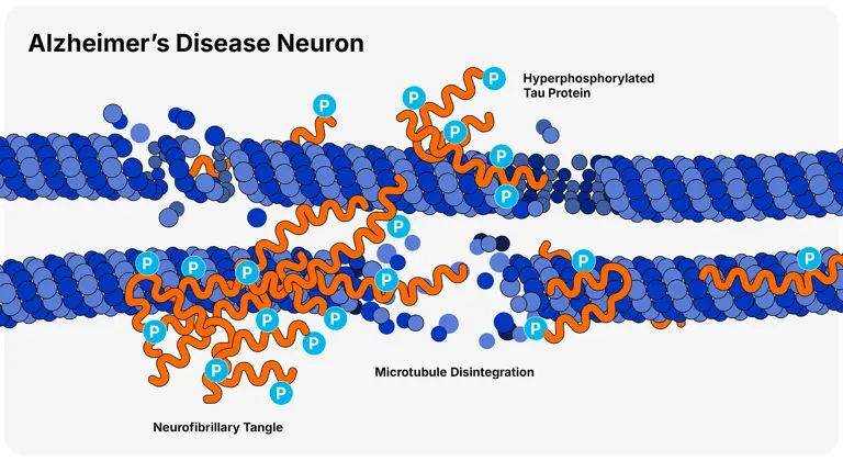 Could this heart health med prevent Alzheimer's instead?