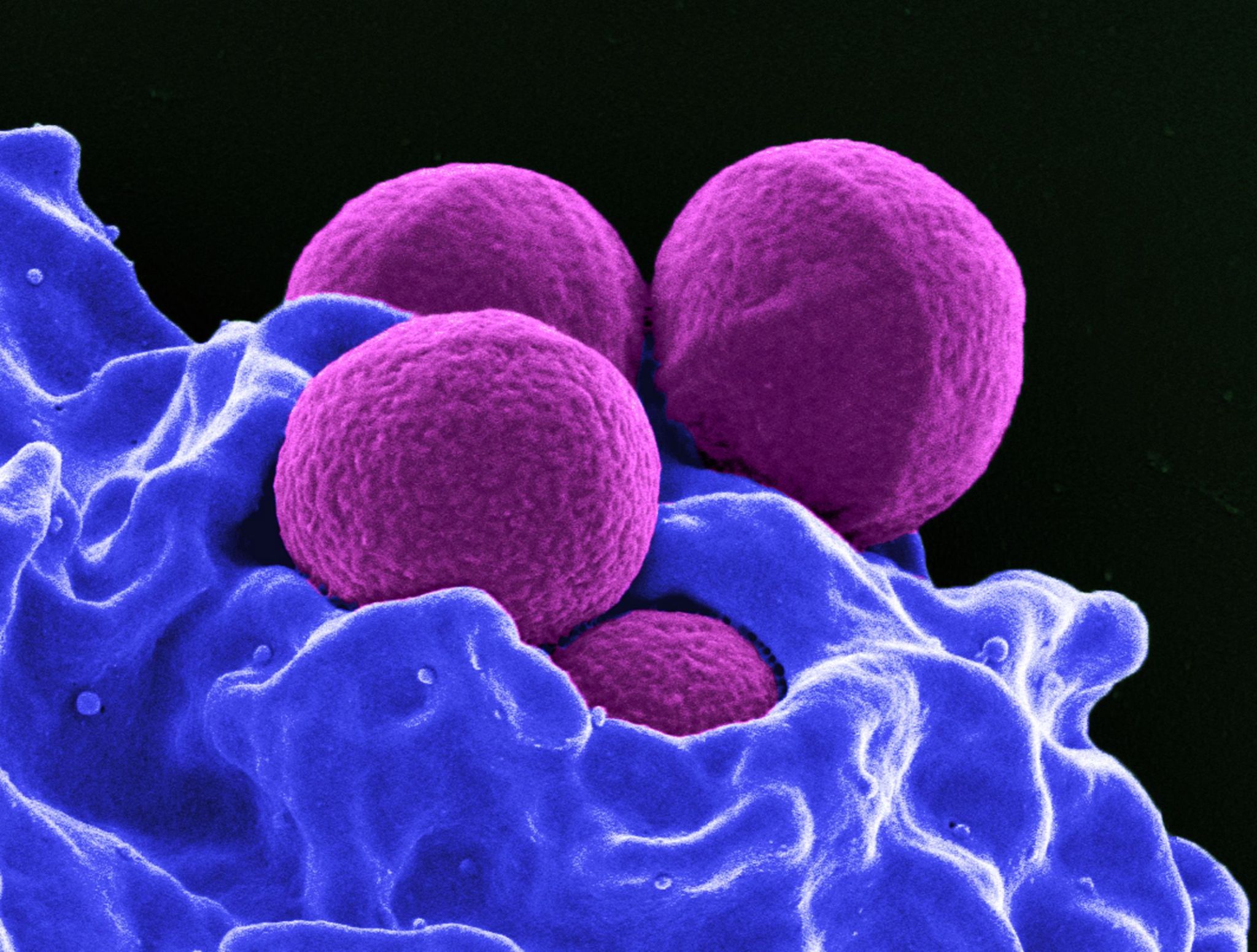 Woman thought she had bug bite—then came life-threatening diagnosis