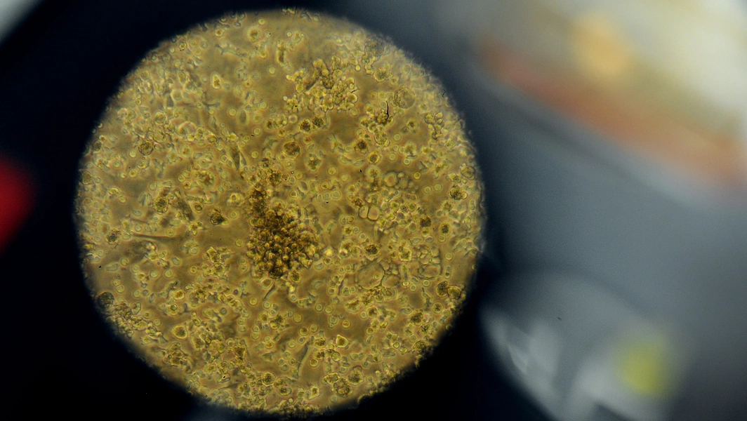 Human body replaces 2 million red blood cells each second