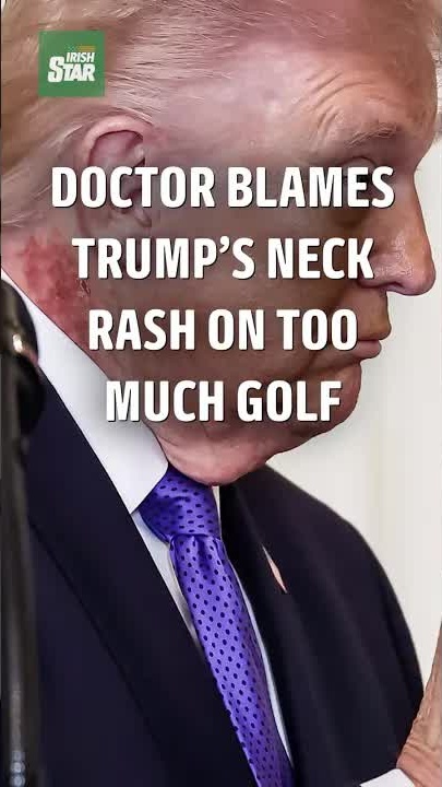 Trump's neck rash blamed on golf habit