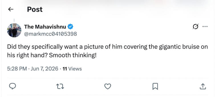New Trump portrait draws social media reaction over his appearance