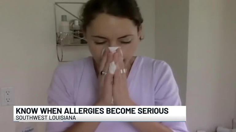 Allergy season hits SWLA hard, doctor warns symptoms can turn serious