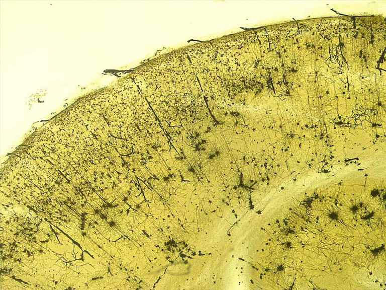 Scientists used a contraceptive drug to grow a tiny spinal cord circuit ...