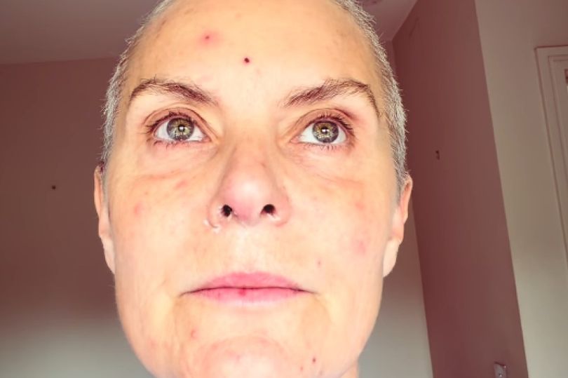 Coronation Street's Tracy Shaw in tears after A&E dash as she undergoes ...